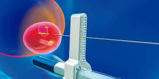 Biopsia - Definición y tipos - El Gen Curioso Tu sitio de ciencias