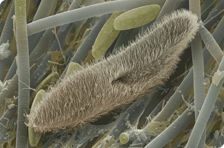 Protozoos: Definición, tipos y ejemplos - El Gen Curioso